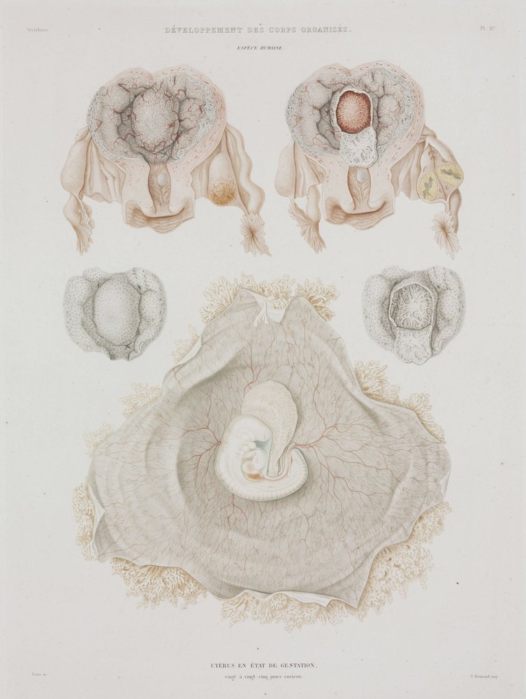 Human Uterus with Embryo, c 1847-1859 by John Pardon