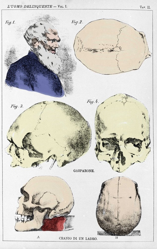 Study on the morphology of a delinquent skull by the Italian criminologist