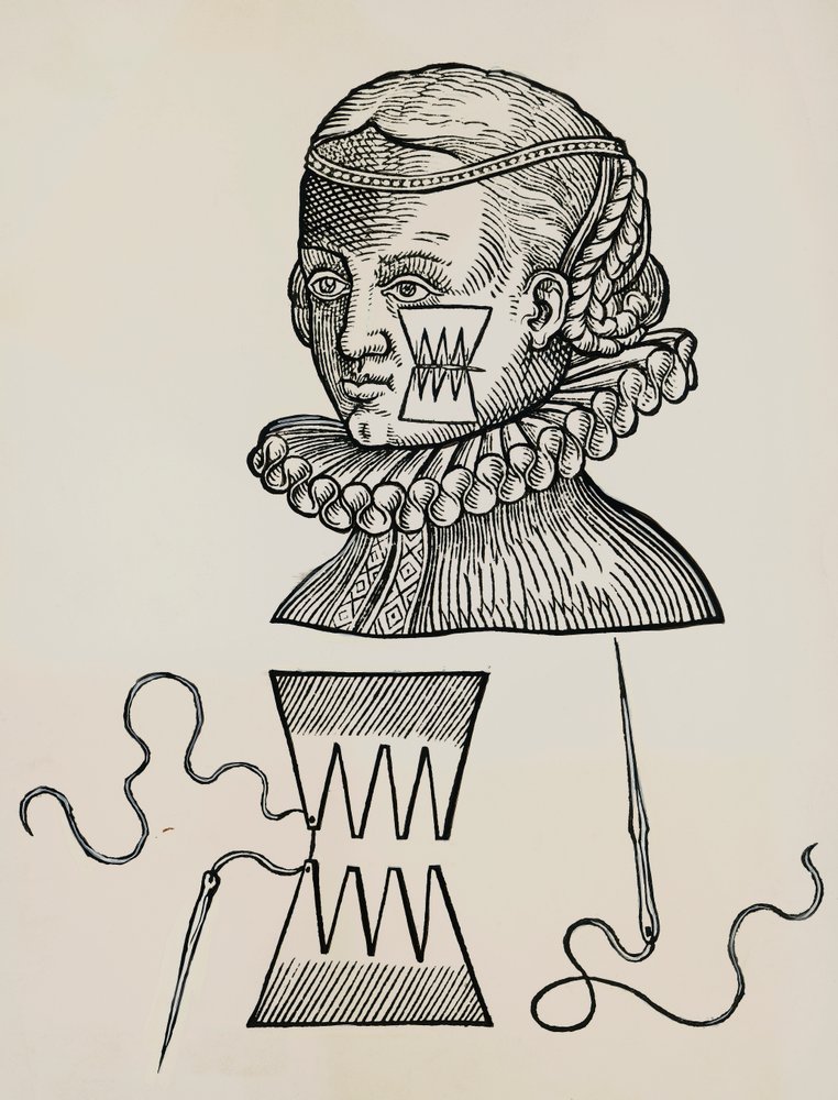 Wound to Cheek Treated with Plasters to Prevent Traces of Stitch Marks ...