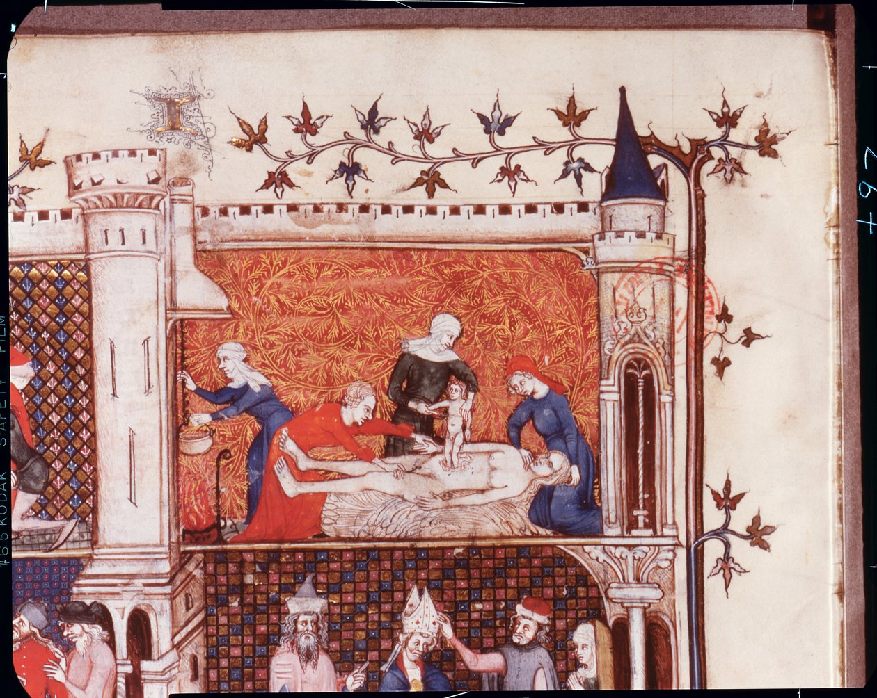 Birth of Julius Caesar, earliest known representation of a caesarian ...