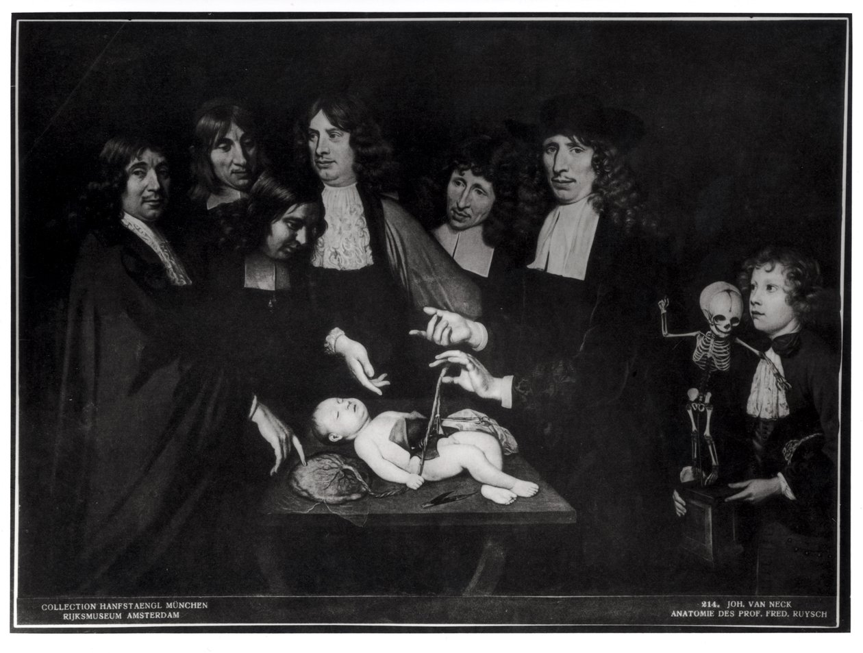 The Anatomy Lesson of Professor Frederik Ruysch